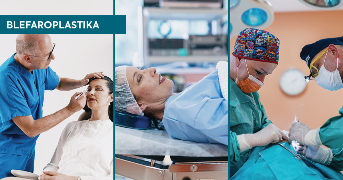 Blefaroplastika – korekcija kapaka | Poliklinika Sinteza