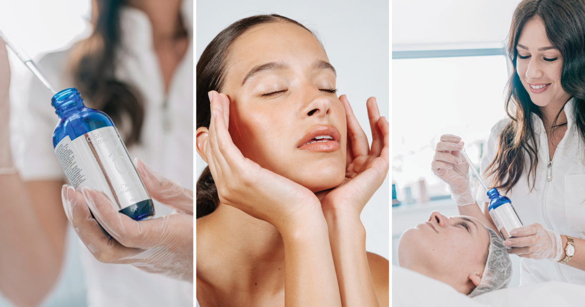 Kemijski piling | Poliklinika Sinteza