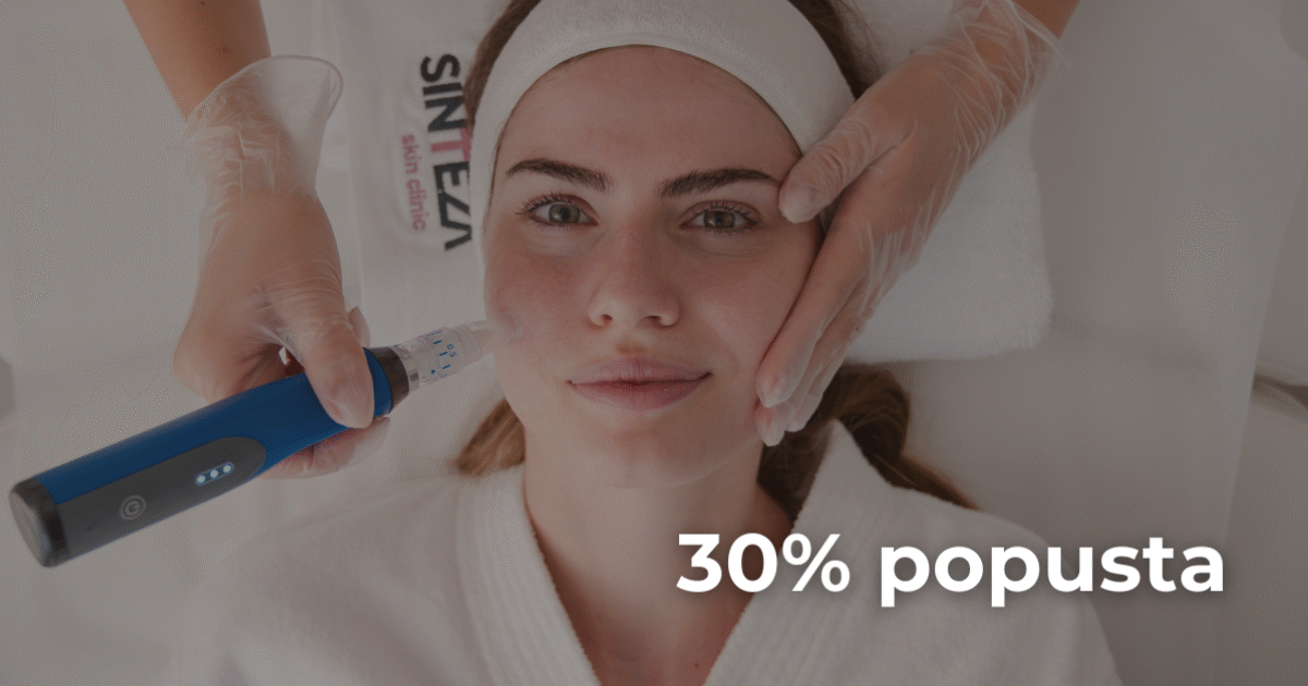 SkinPen – Terapija mikroiglicama | Poliklinika Sinteza